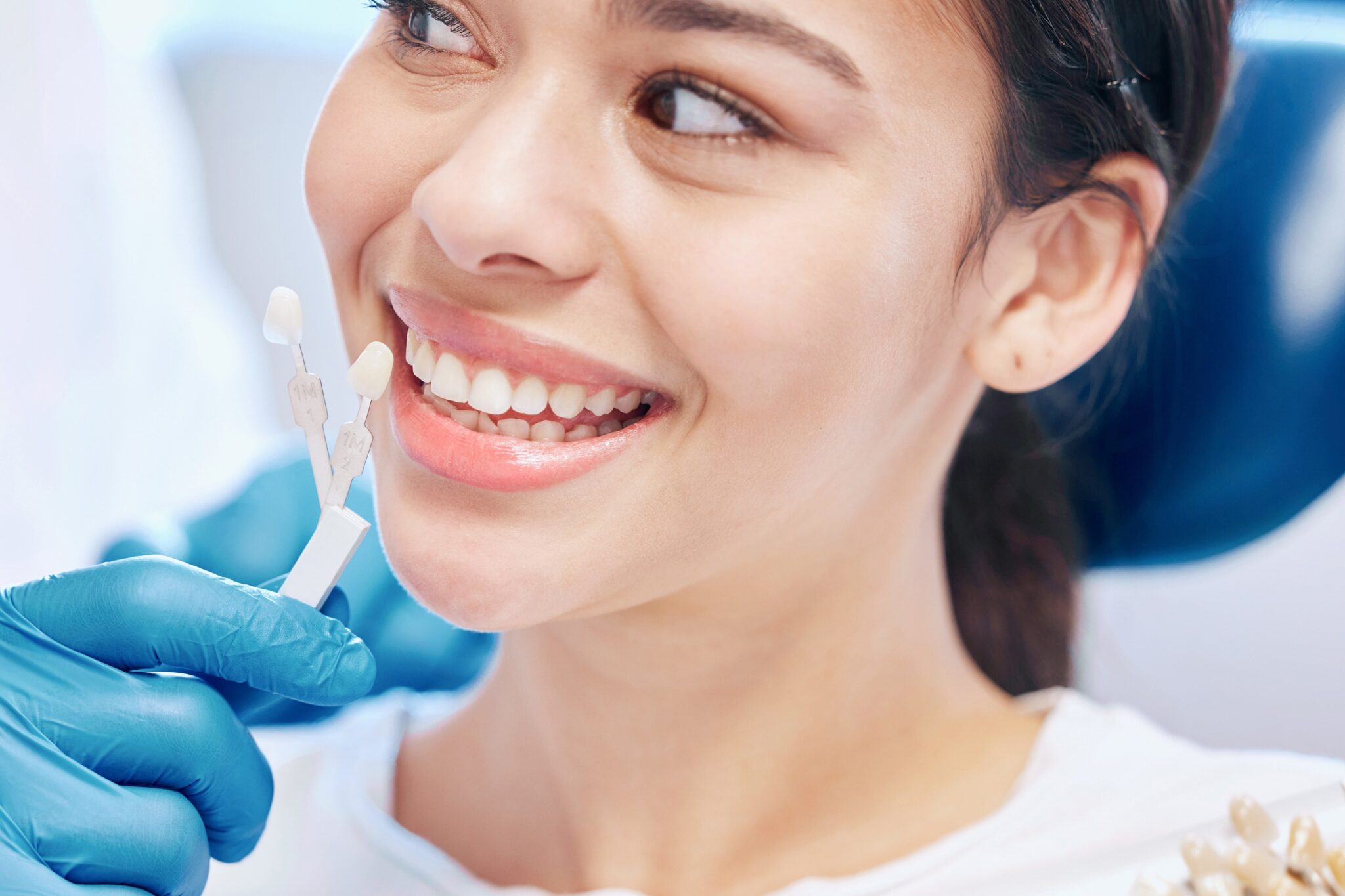 Non-Prep Fasader – Stigbergstandläkarna